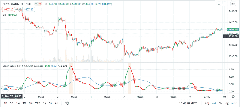 Ulcer Index Indicator – Concept, Calculation, Usage, Benefits & more